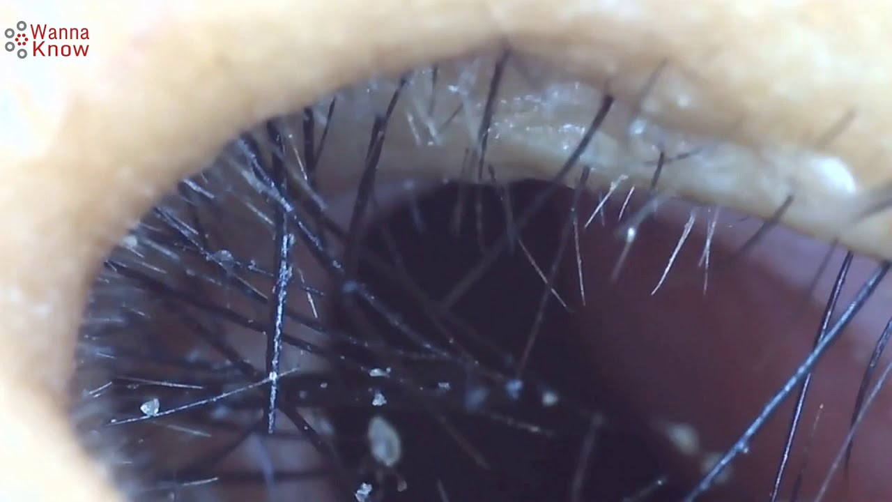zoom body parts - YouTube