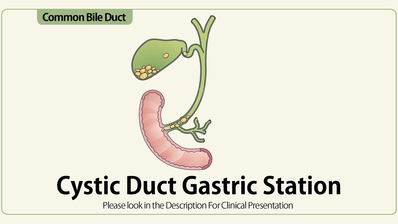 Cystic Duct - Gastric View - YouTube