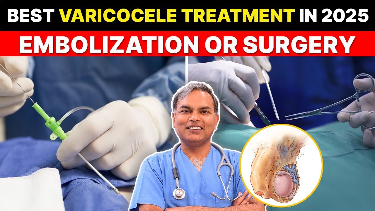 Varicocele के इलाज में क्या है बेहतर? Surgery या Embolization ...