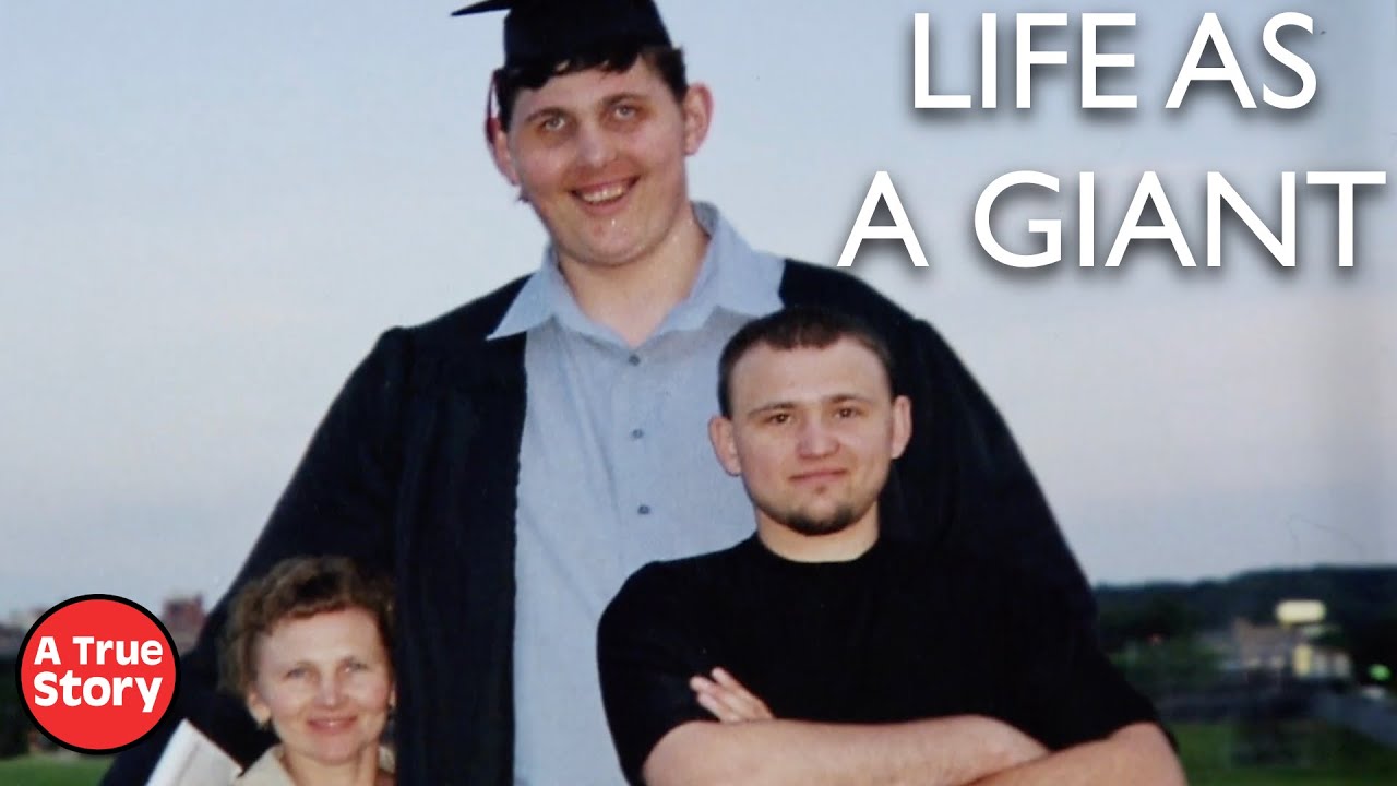 Living as a Giant: The People Who Can’t Stop Growing | A True Story ...