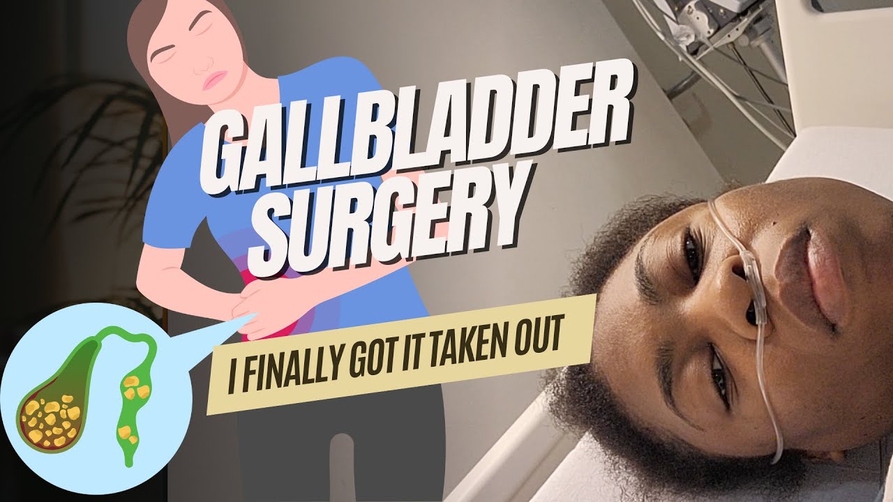 my-journey-to-removing-my-gallbladder-youtube