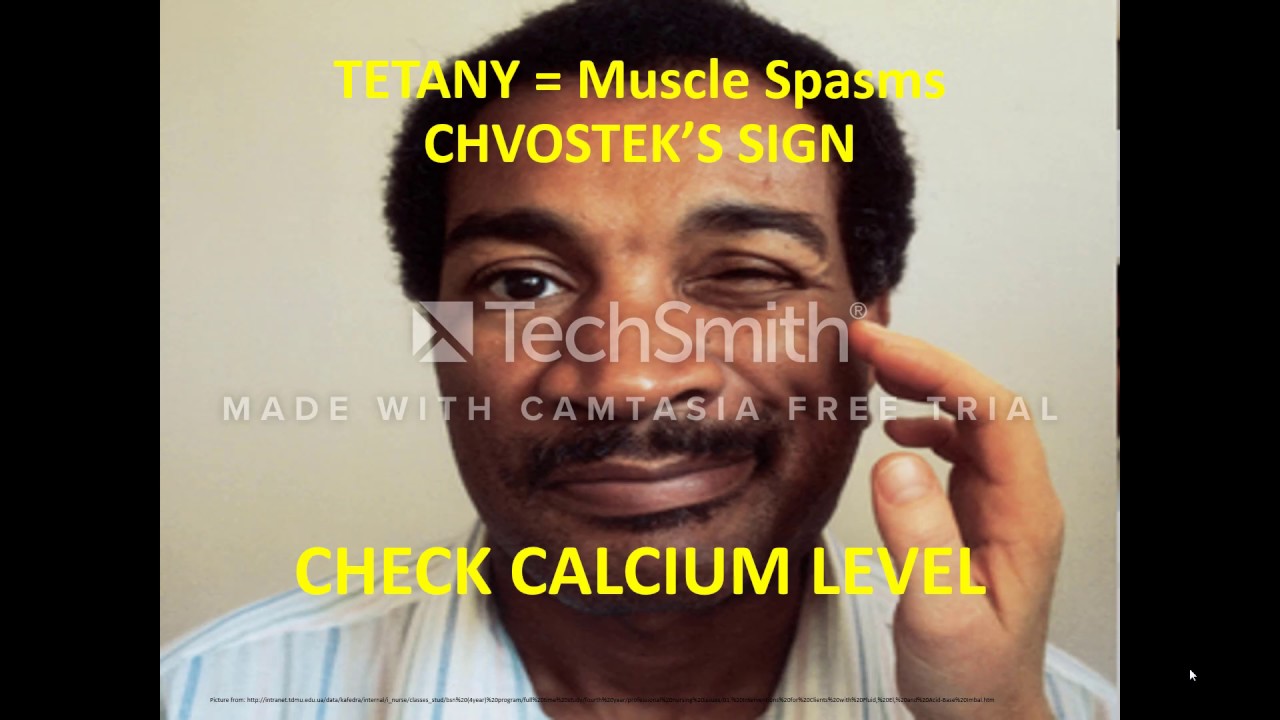 Endocrine Physical Exam PEARLs - YouTube