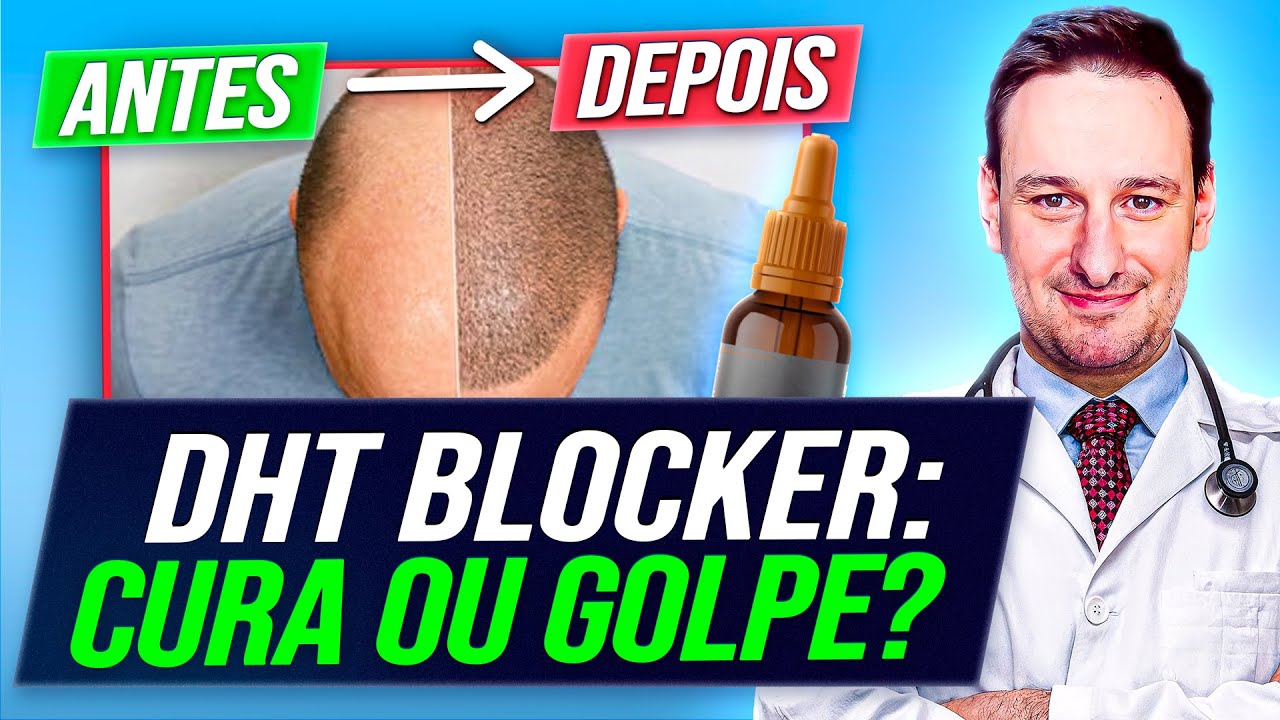 DHT BLOCKER é golpe? Para a CALVÍCIE? Funciona? - YouTube