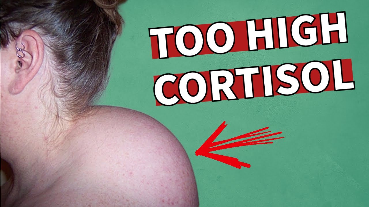 9 Signs You Have HIGH Cortisol - YouTube