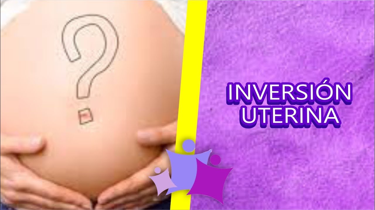"SE ME DIO VUELTA EL UTERO DESPUÉS DEL PARTO" - INFOPARTO - YouTube
