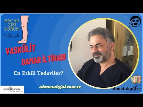 Vaskülit (Damar İltihabı) nedir, nasıl tedavi edilir - Prof Dr Ahmet AKGUL