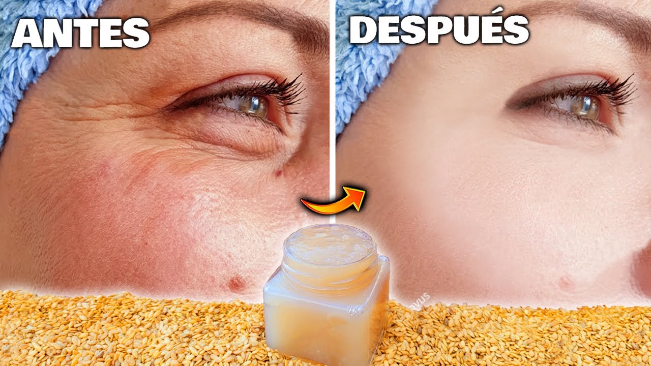 UN MILLÓN de VECES MÁS EFICAZ que el BOTOX | Elimina ARRUGAS y MARCAS ...
