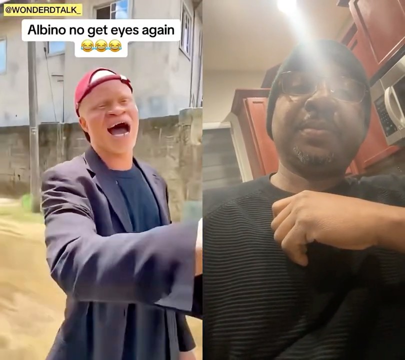 Fresh Albino’s eyes has done it again #foryou #duet #funny #fyp - YouTube