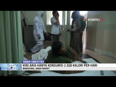 Bocah Obesitas Aria Lakukan Diet Ketat