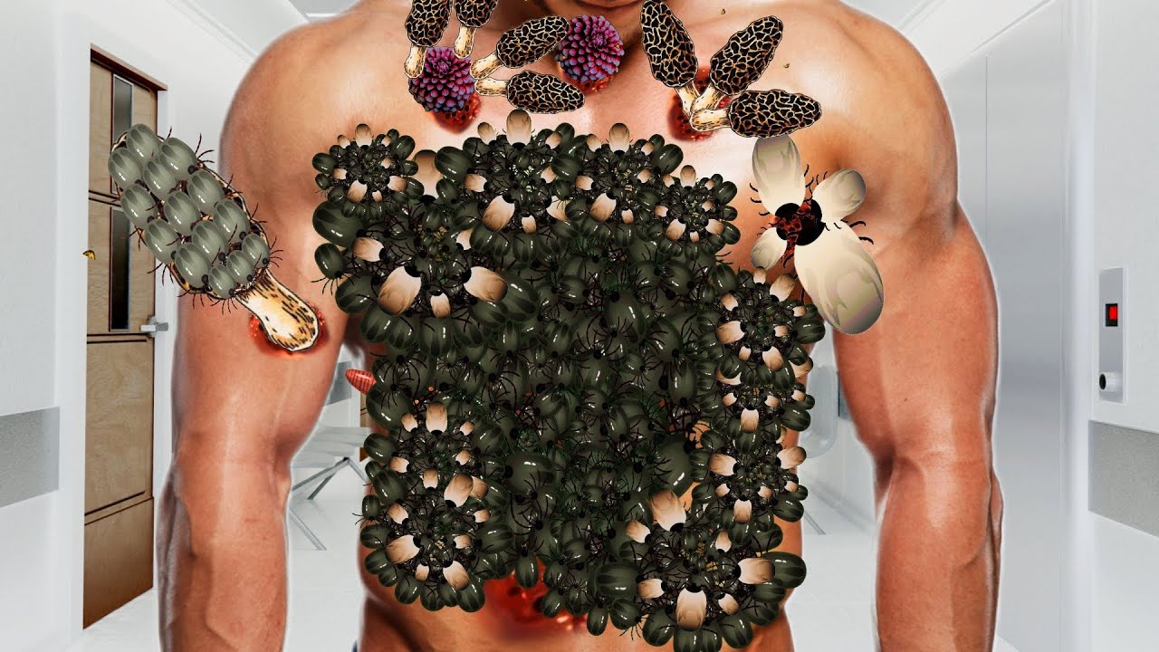 ASMR dog tick & Maggot removal infected Body | ASMR maggot removal ...