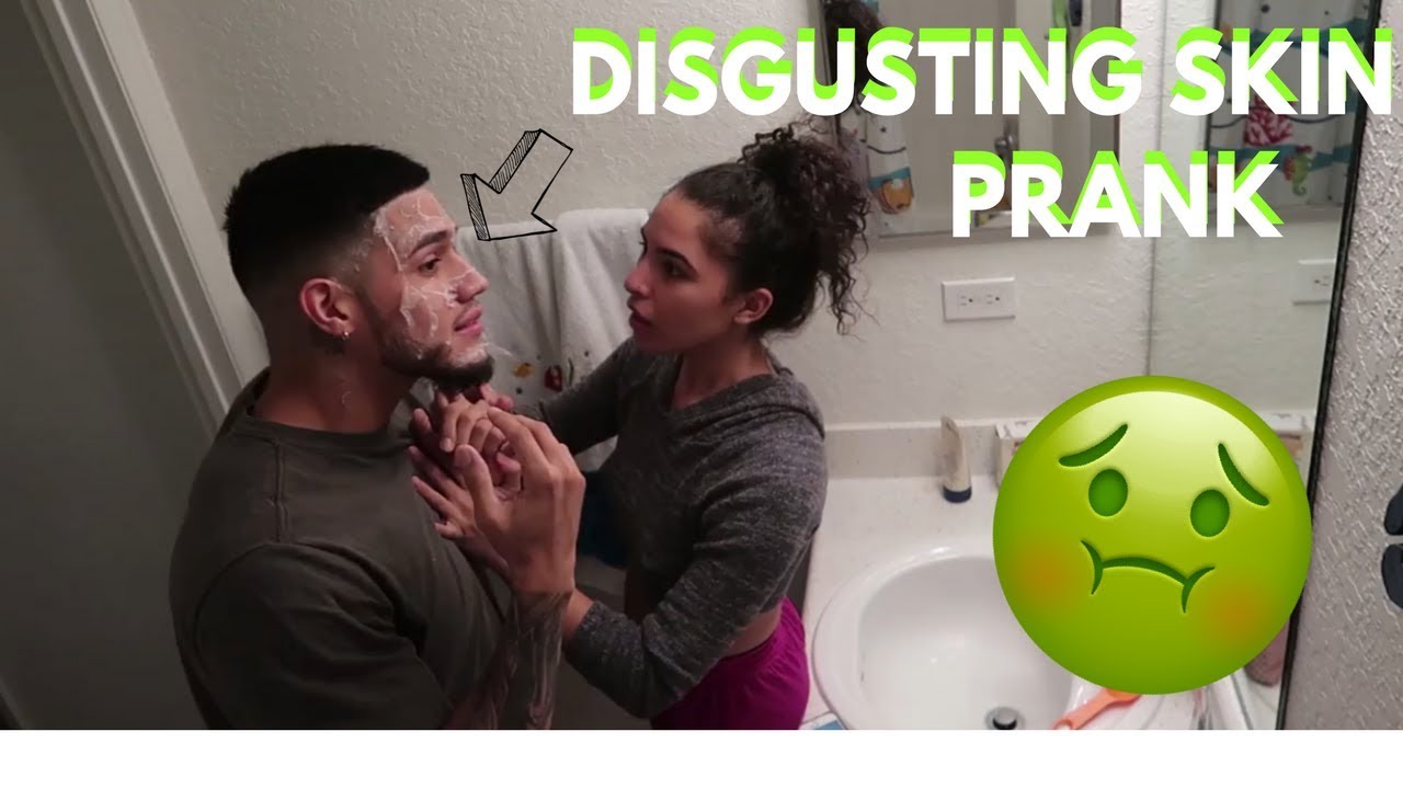 DISGUSTING SKIN PRANK / COUPLES PRANK - YouTube