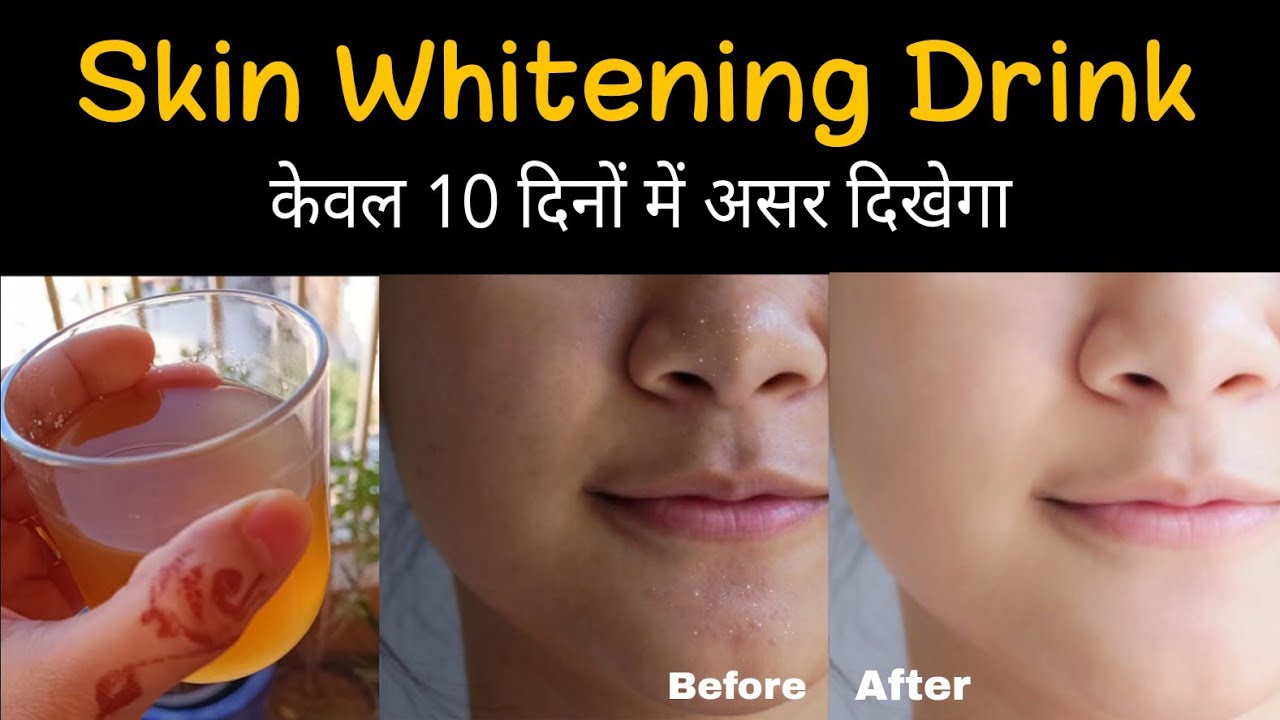 Skin Whitening Drink only 3 ingredients | Results in just 10 Days ...