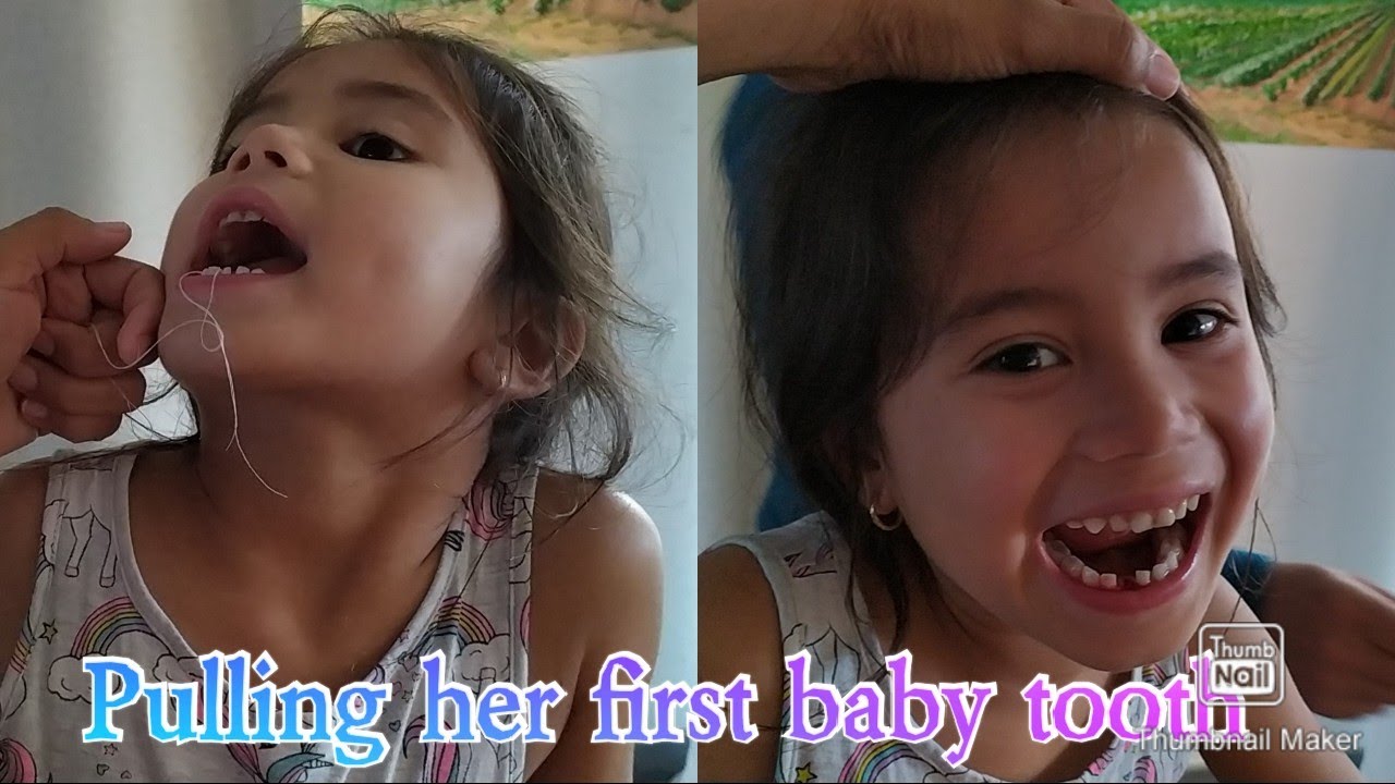 How to pull out a baby tooth at home | Teeth pulling method | Easy ...