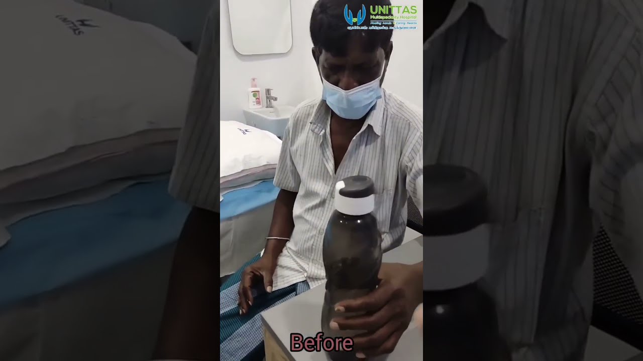 A tremor is a rhythmic shaking movement in one or more parts of your ...