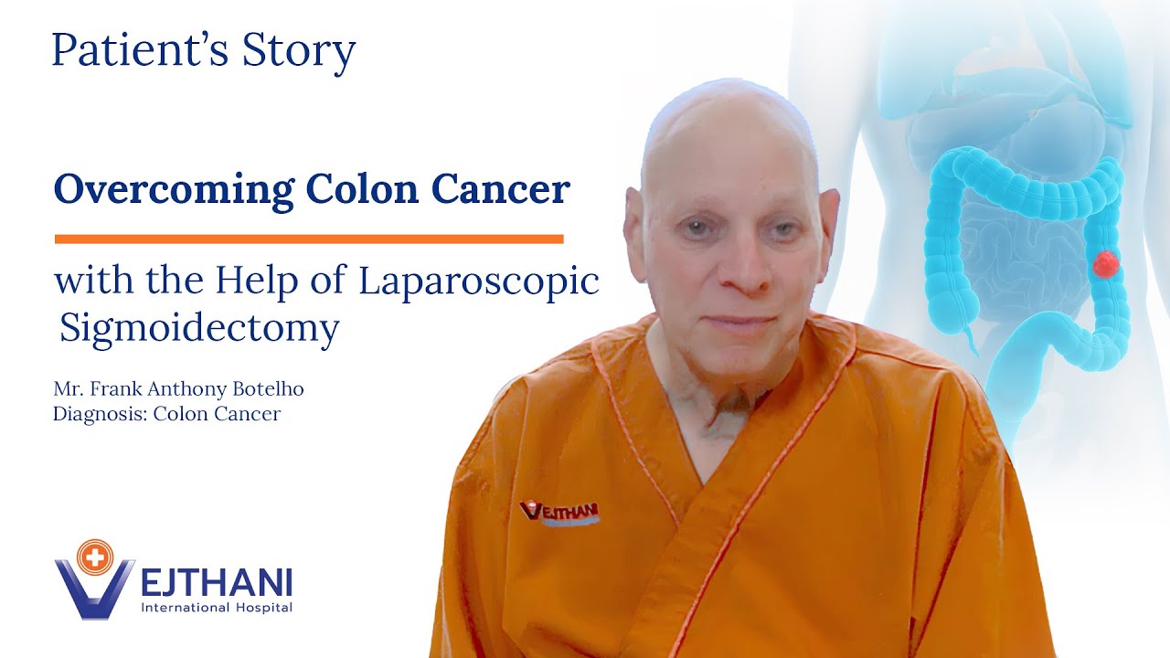 Overcoming Colon Cancer with the Help of Laparoscopic Sigmoidectomy ...