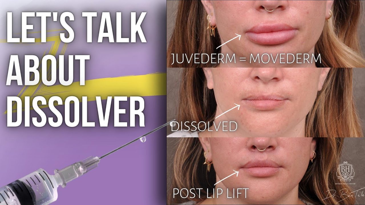 Let's Talk About Dissolver | Lesson Of The Day - YouTube