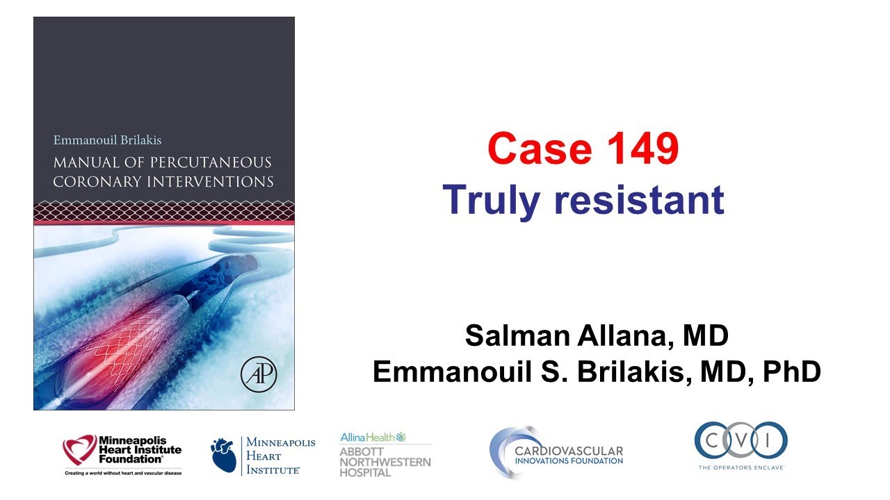 Case 149: PCI Manual - Truly resistant lesion - YouTube