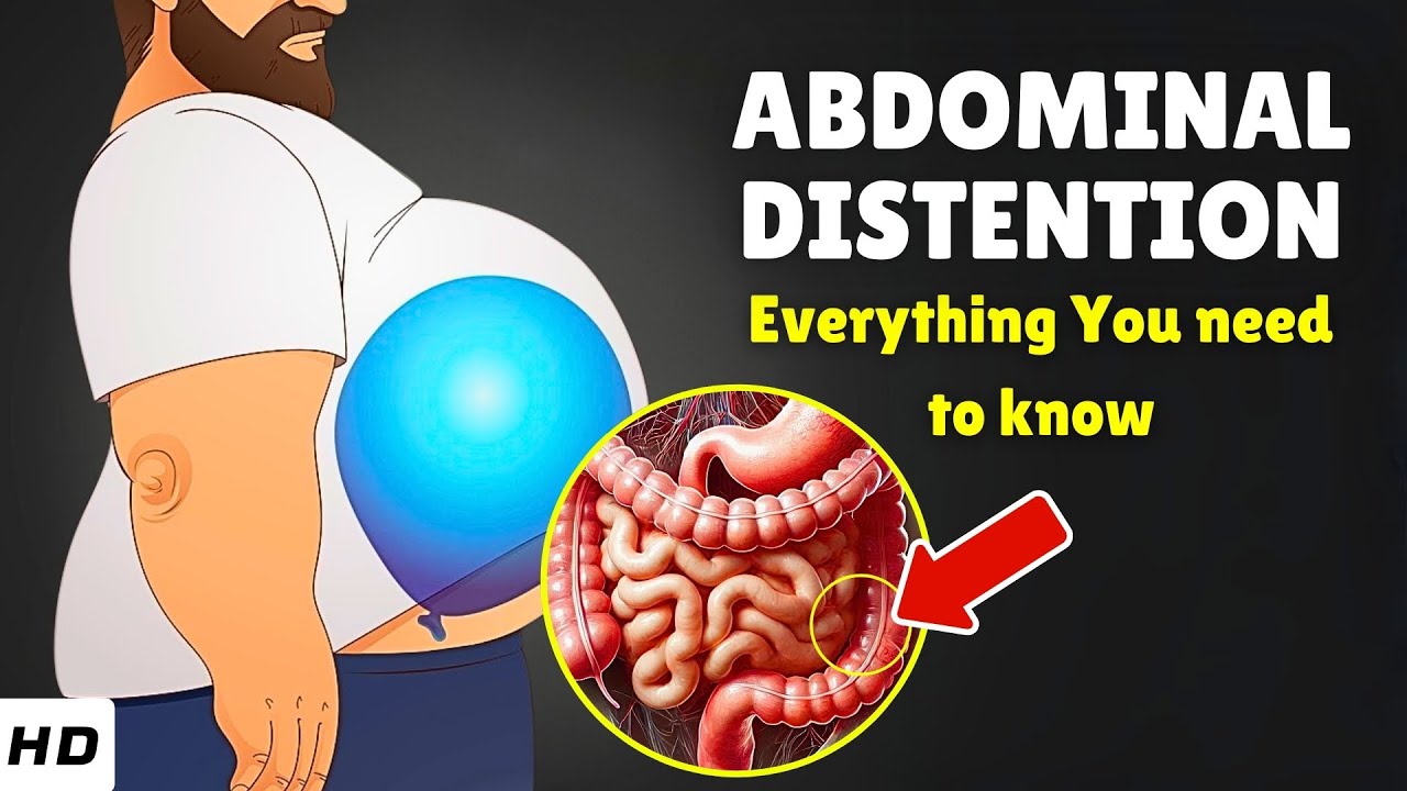 Abdominal Distention: What’s Causing Your Belly to Swell, When to Worry ...