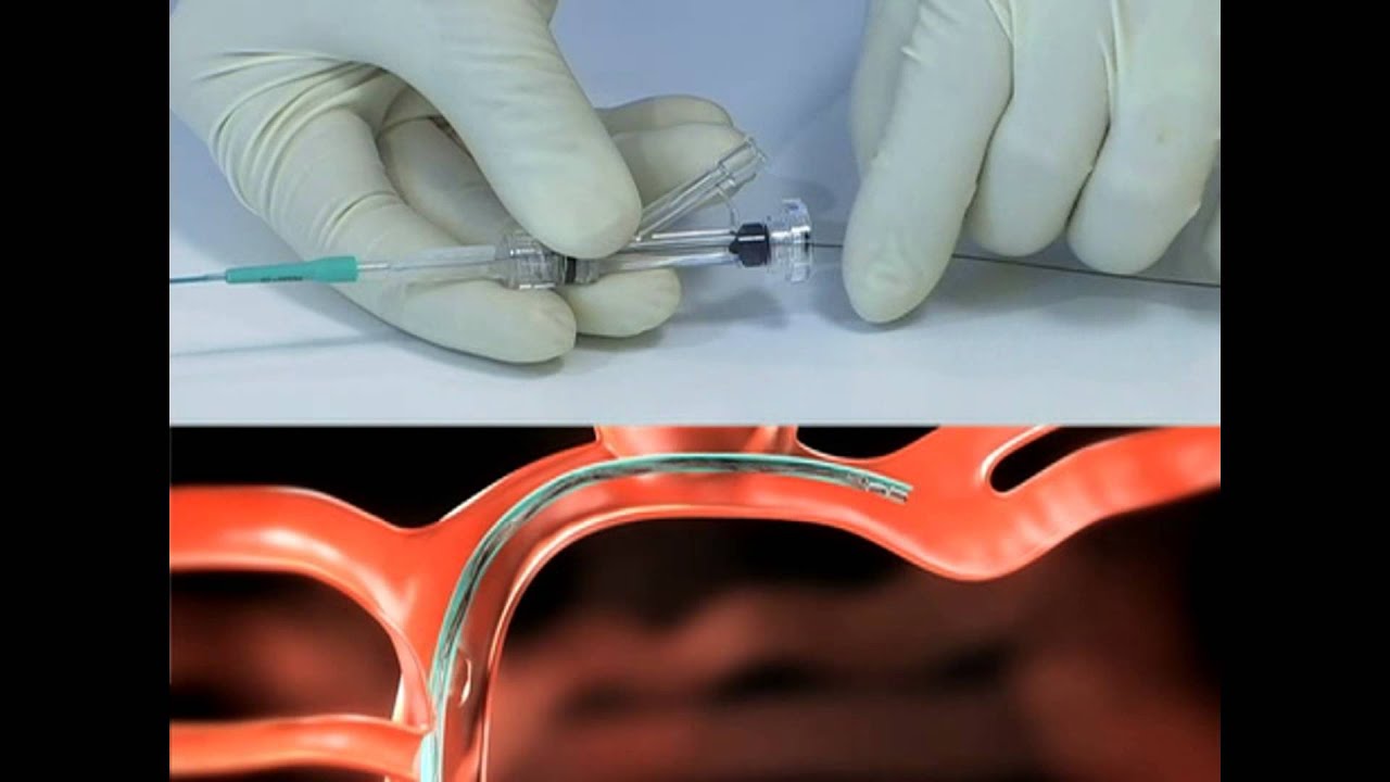 Solitaire AB - YouTube