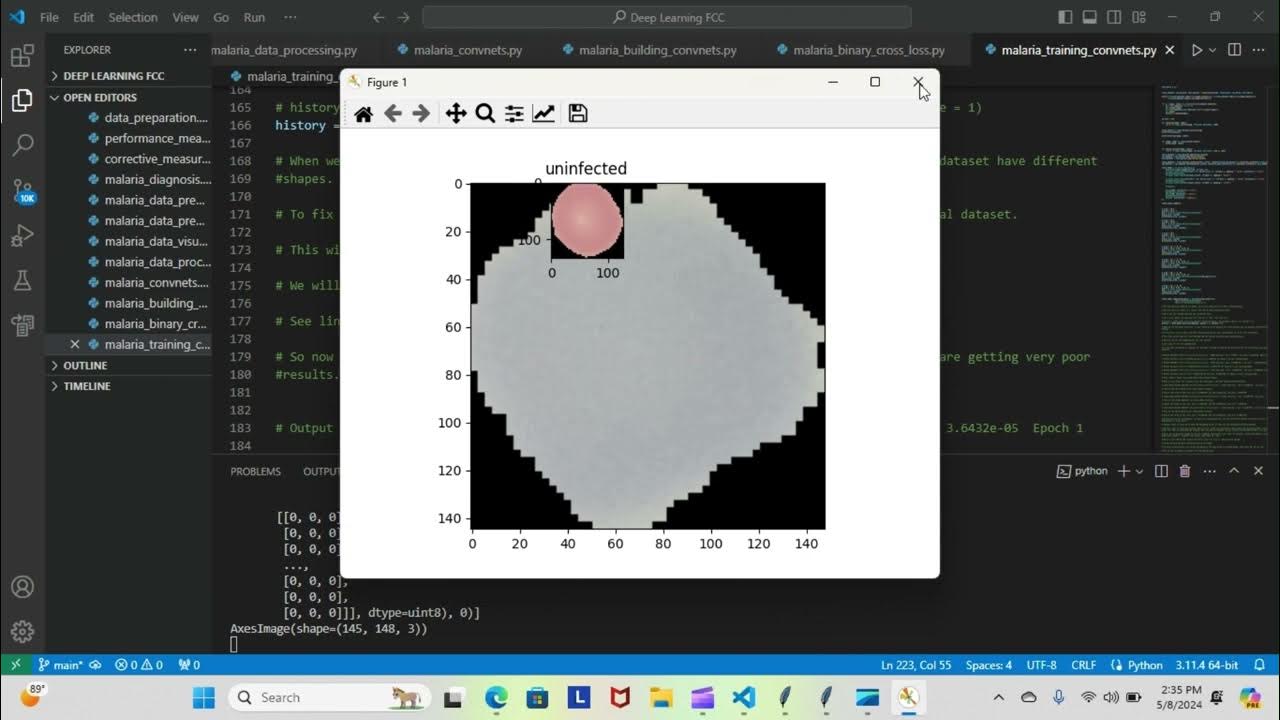 Python Papi / TensorFlow Day 85 - Building Neural Networks - Part 66 - YouTube