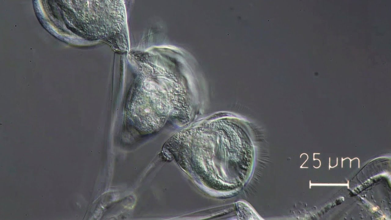 Carchesium sp., a peritrichous protozoan. - YouTube
