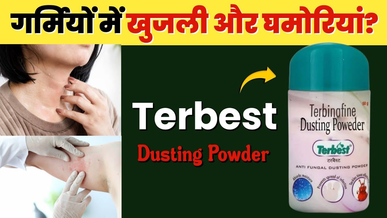 Terbinafine Dusting Powder Terbest Antifungal | Powder For Fungal ...