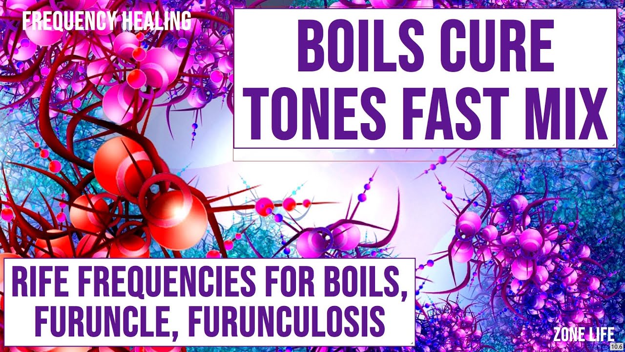 Rife Frequencies for Boils, Furuncle, Furunculosis : Fast Mode : Skin ...