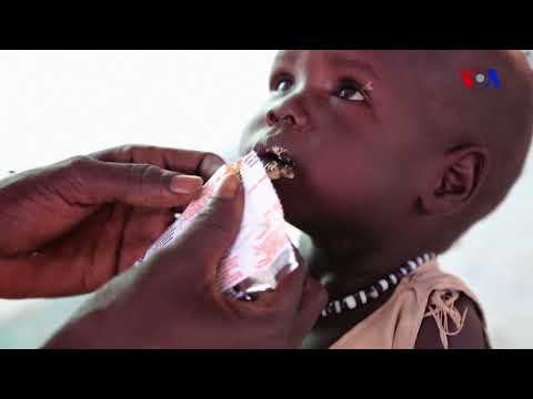 Afrika ölkələrində açlıq