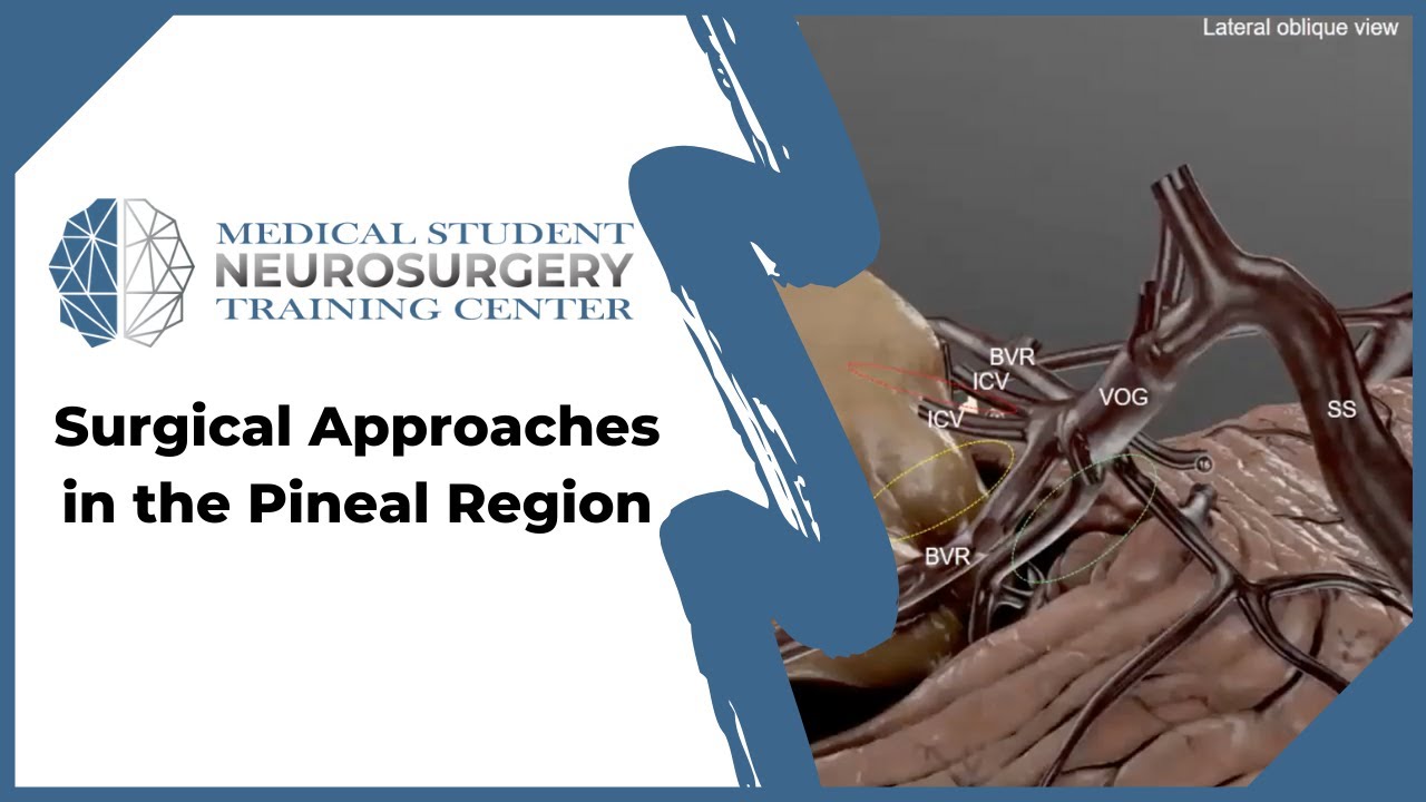 Surgical Approaches in the Pineal Region - YouTube