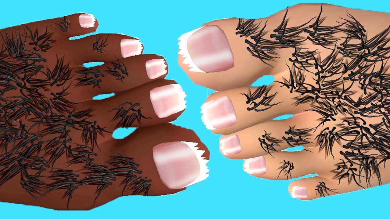 Foot Clinic - Gameplay Walkthrough - All Levels (IOS, Android) - YouTube