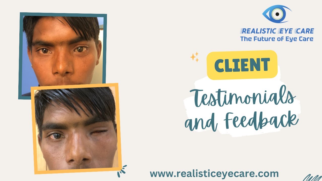 Client Testimonials for Artificial Eye Services by Realistic Eye Care ...