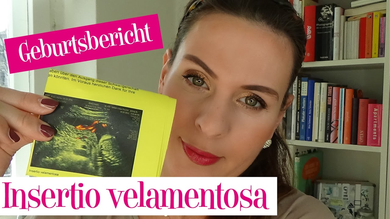 ‪Insertio Velamentosa / Vasa Praevia / Nabelschnuranomalie / Geburt ...