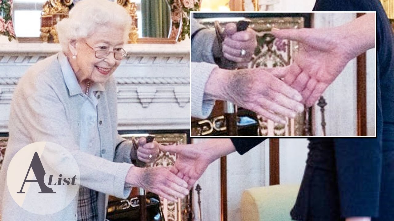 Our Queen looks frail with bruised hand during new PM Liz Truss ...