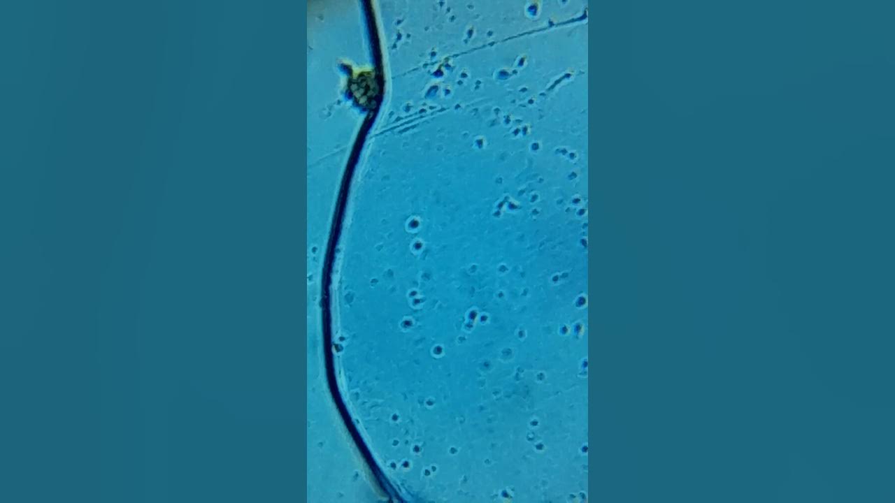 UK pond water under microscope - YouTube