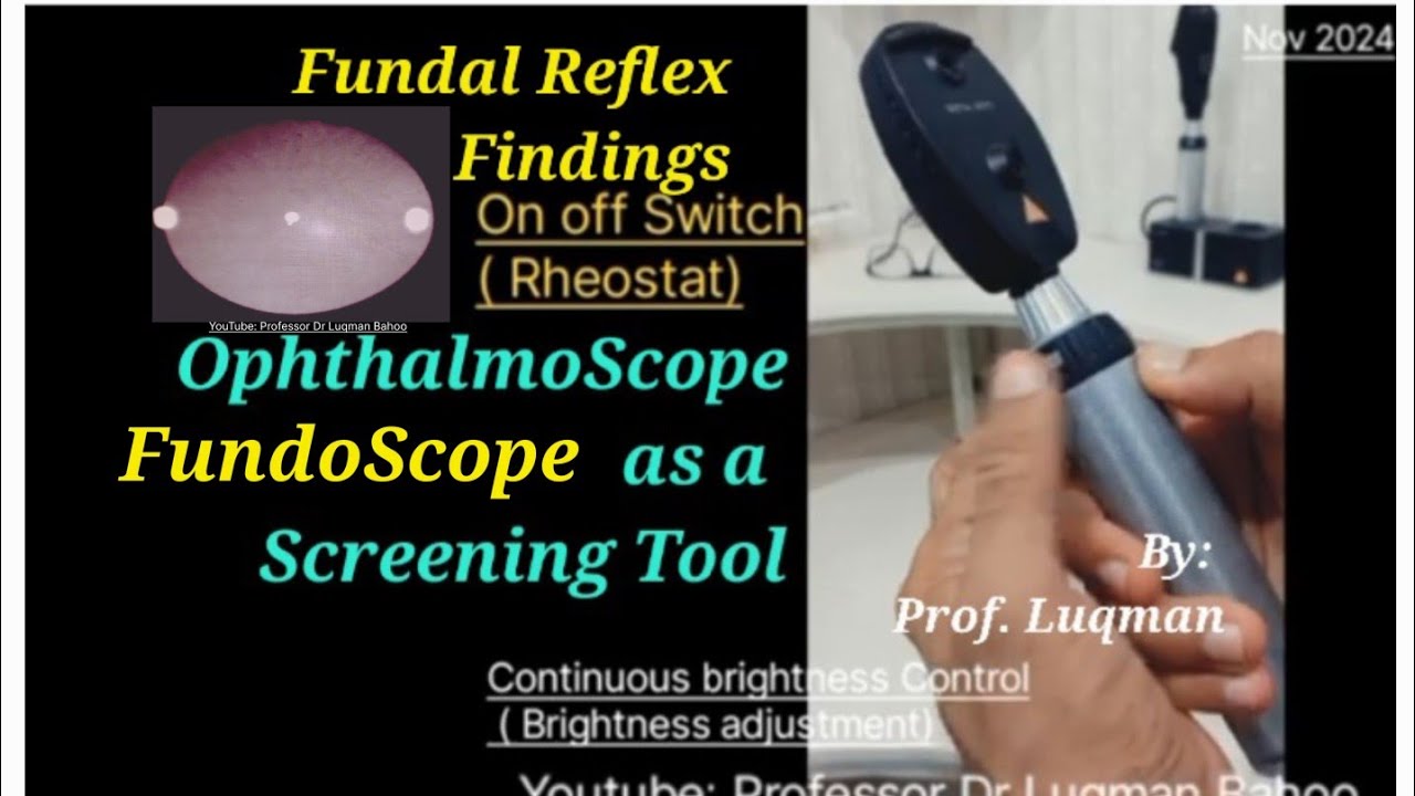 "Fundal Reflex" or The Red Reflex a Screening Tool for any Doctor ...