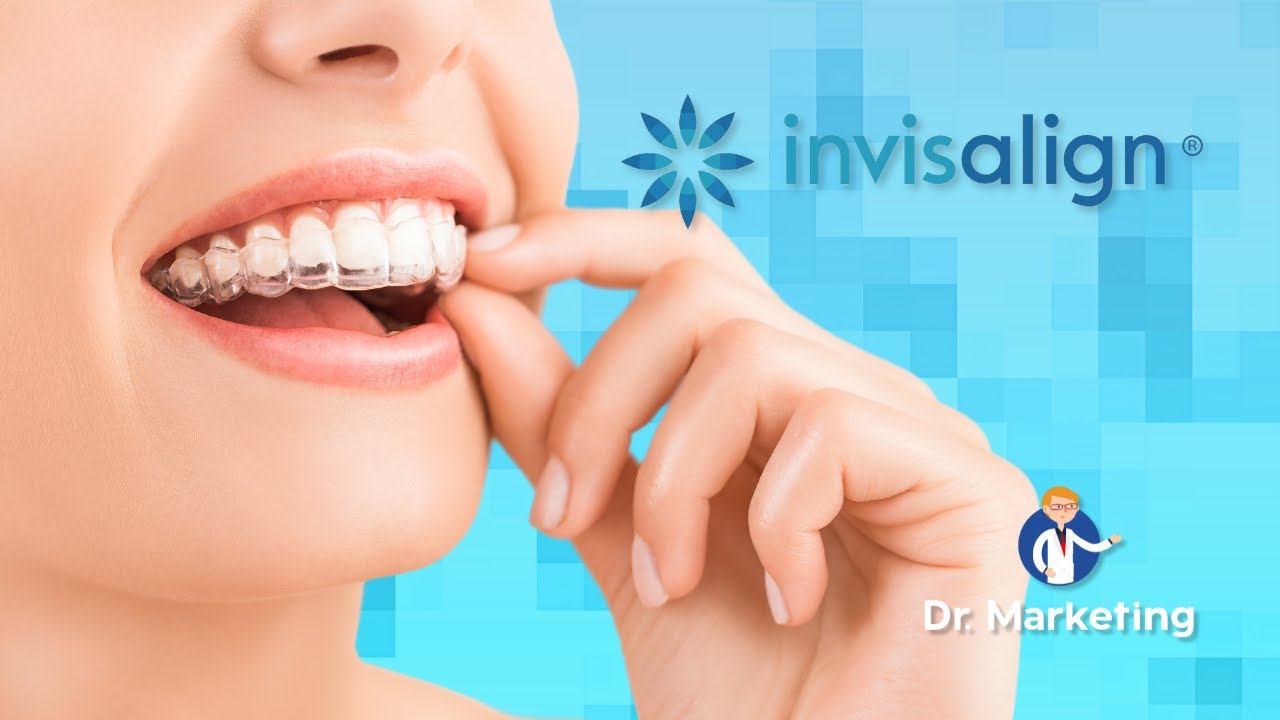 Invisalign Onboarding Video | Dr. Marketing - YouTube