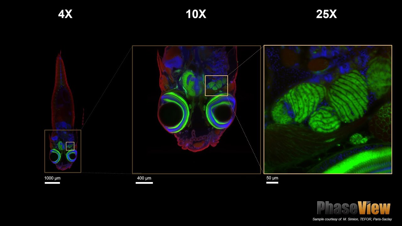 Automatic Multi-Scale Imaging in PhaseView Alpha3 Facility Edition Light Sheet Microscope - YouTube