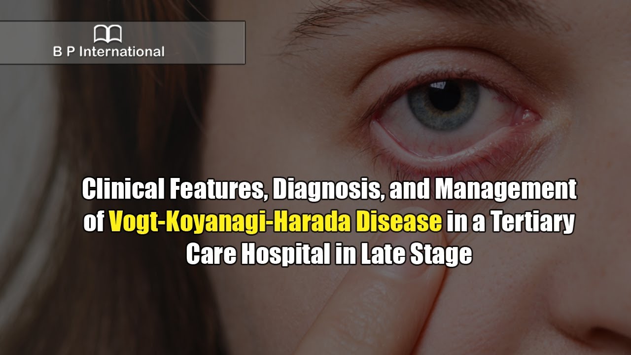 Clinical Features, Diagnosis, and Management of Vogt-Koyanagi-Harada ...
