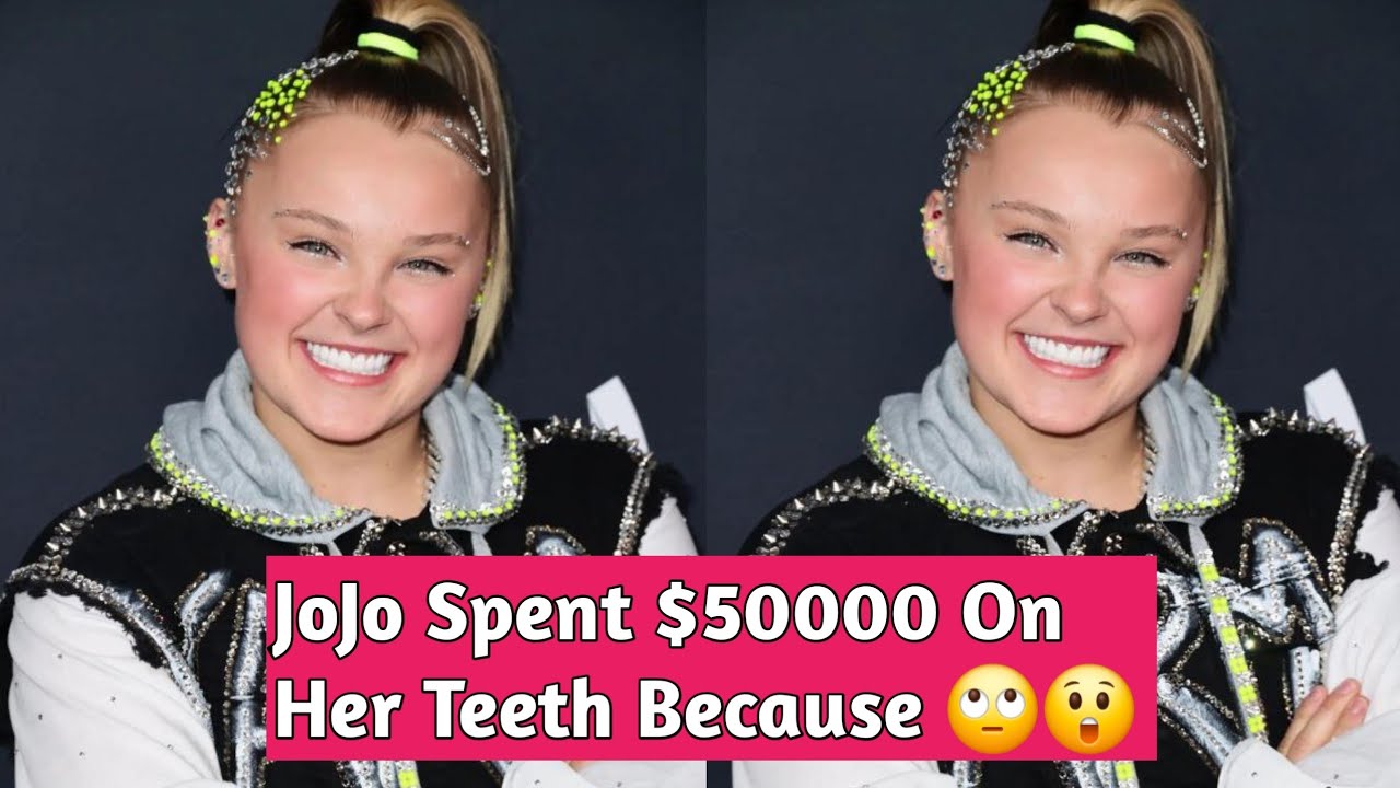 Jojo Siwa Spent $50,000 To Change Her Teeth Because She Felt "Insecure ...
