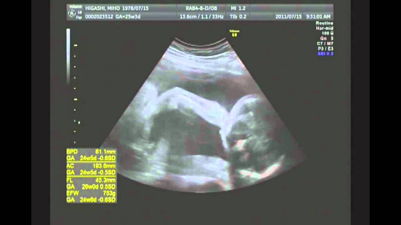 Nuestra Beba - 1er Video.wmv - YouTube