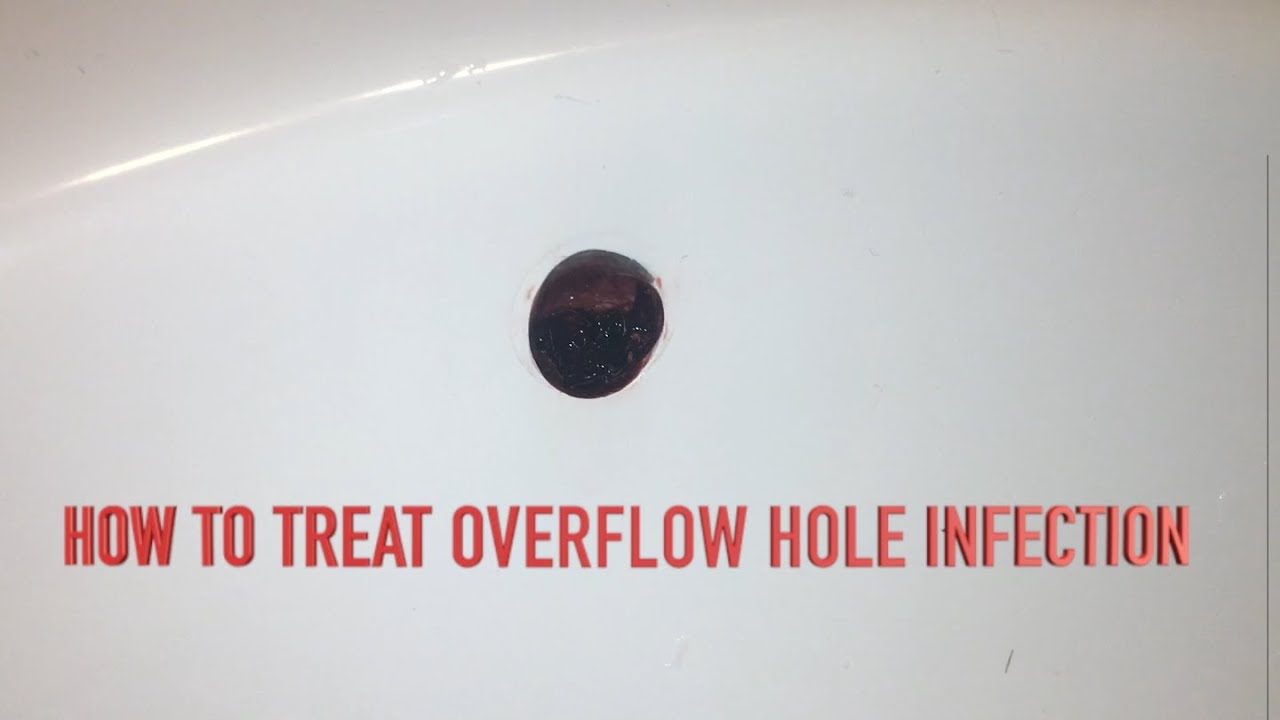 How to Treat Overflow Hole Infection - YouTube