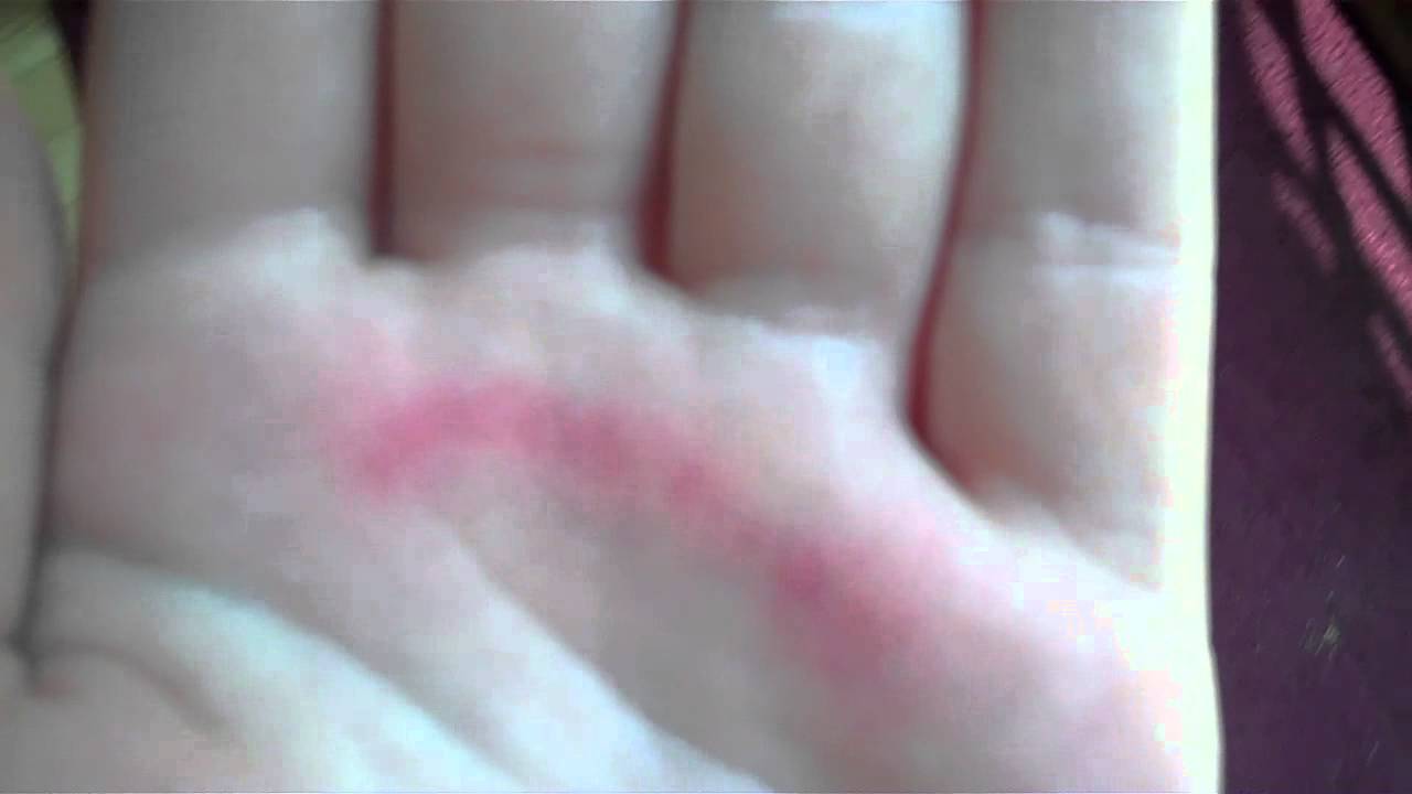 Salt and Ice Challenge Results - YouTube