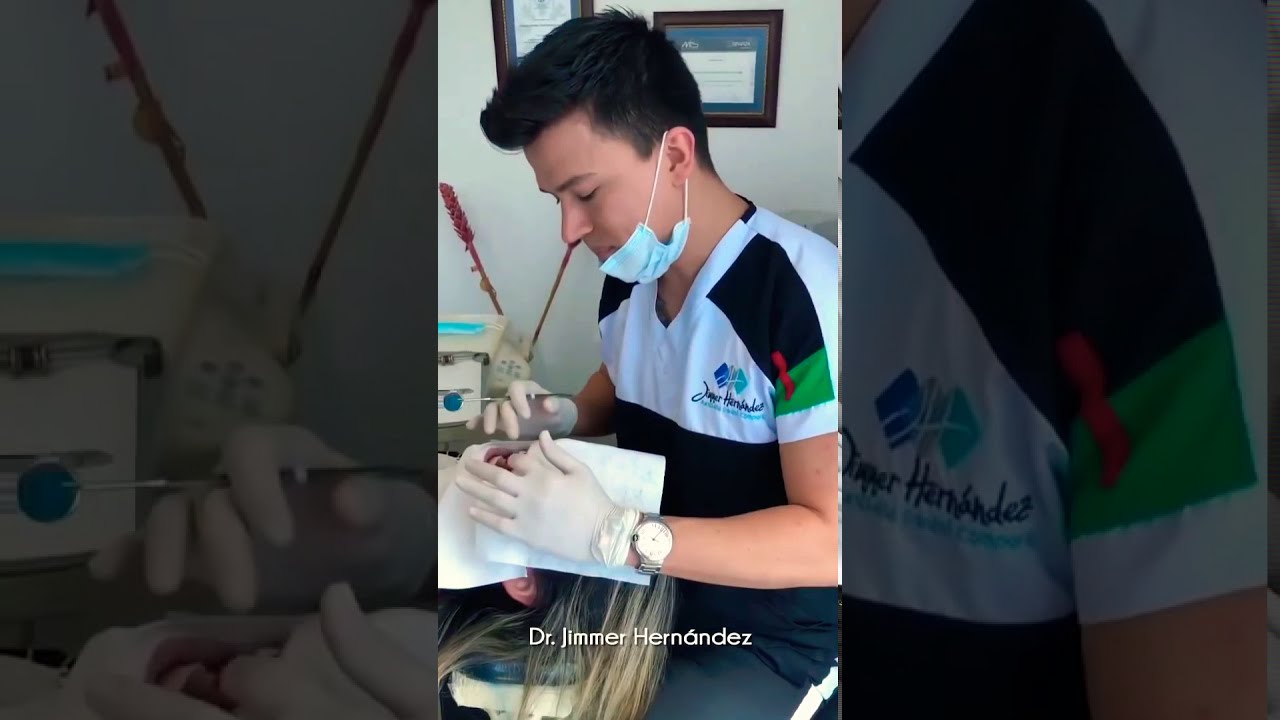 Gingivectomia, gingivoplastia, diseño de encias o nivelación del cenit ...