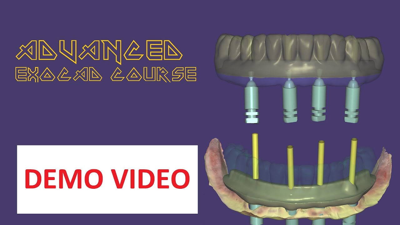 DEMO of ADVANCED Split-Bar-Bridge technique VIDEO (Full video in ...