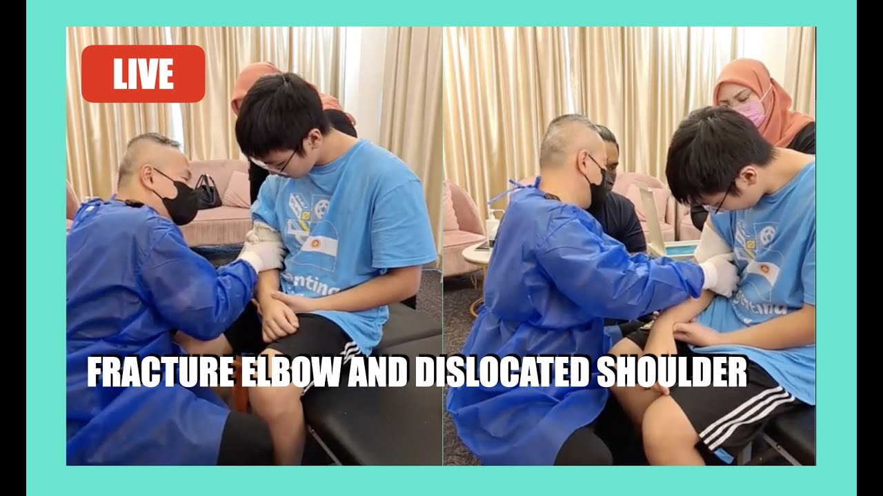 TOP 5 MOST | FRACTURE ELBOW AND DISLOCATED SHOULDER - YouTube