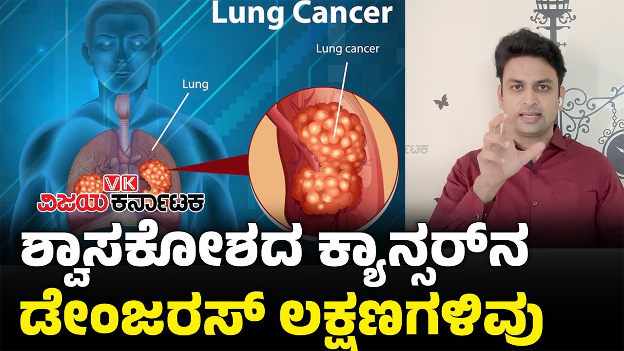 Lung Cancer : ಶ್ವಾಸಕೋಶದ ಕ್ಯಾನ್ಸರ್ ಈ ಕಾರಣಗಳಿಂದಲೇ ಬರುತ್ತೆ ಎಚ್ಚರ! | Vijay ...