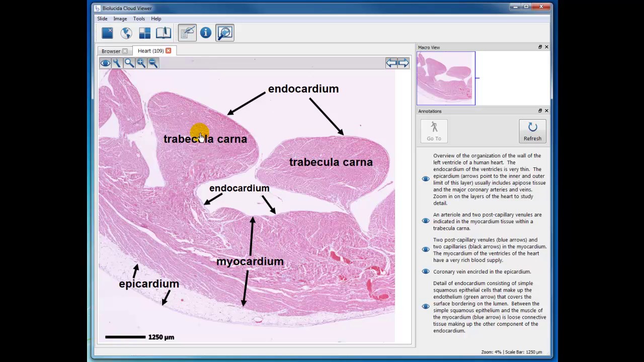 Module 3 Heart Specimens - YouTube