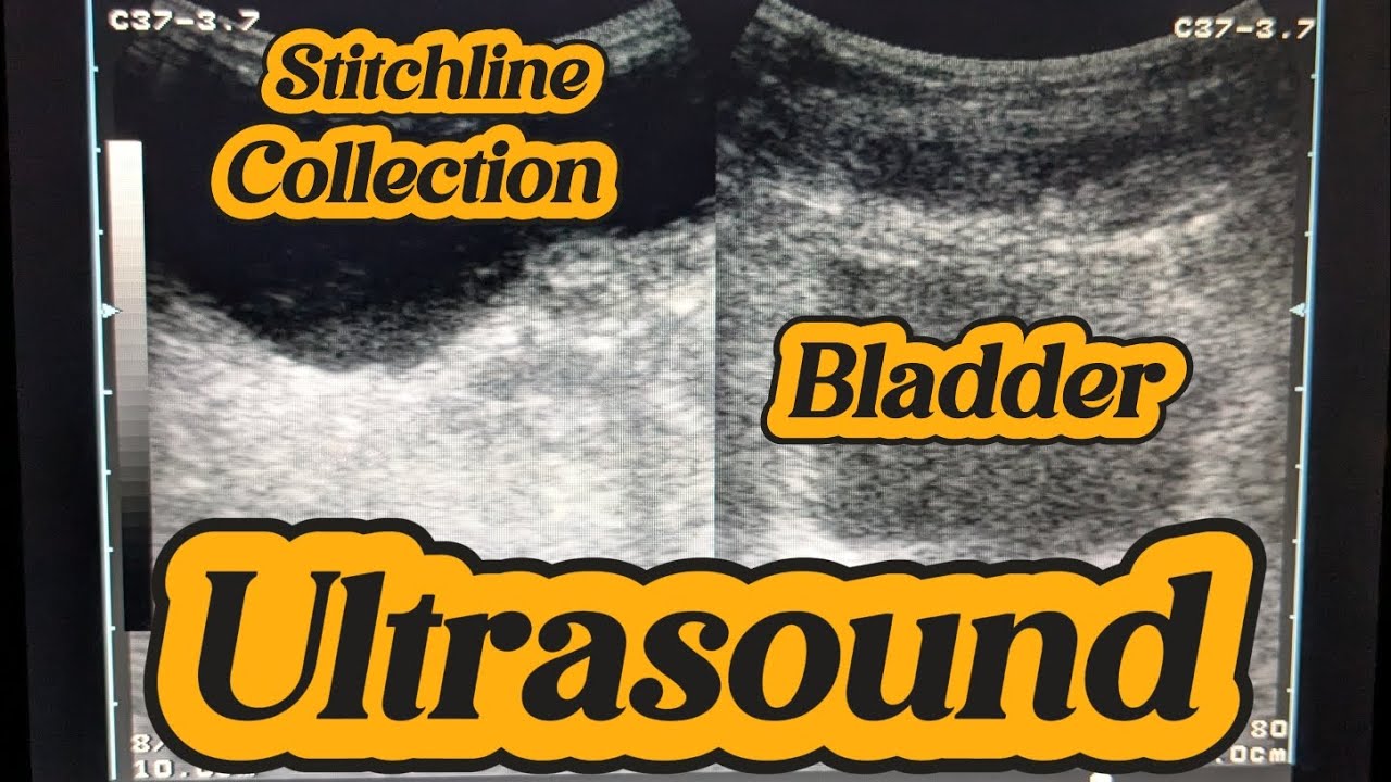 Diagnosing Subcutaneous Collection with Ultrasound | Stitch Line ...