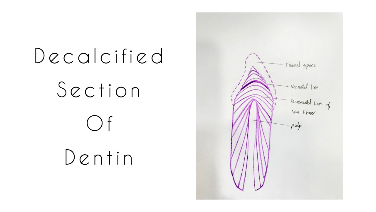 Drawing of Dentin - Decalcified section - YouTube