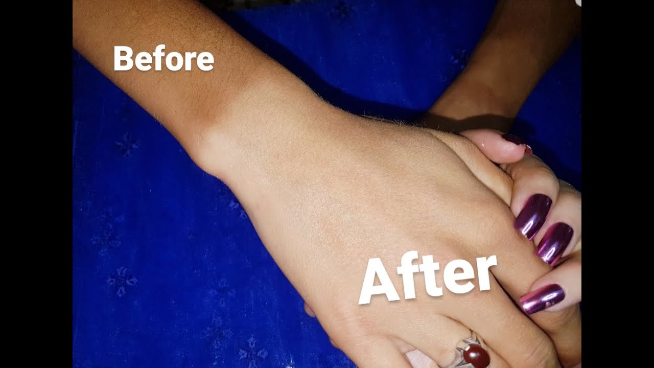 Get instant white hands and feet/whiting - YouTube